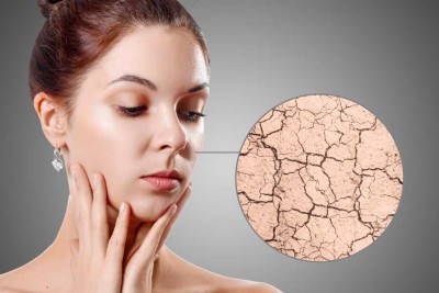 Dried out skin:Some effective strategies to overcome it
