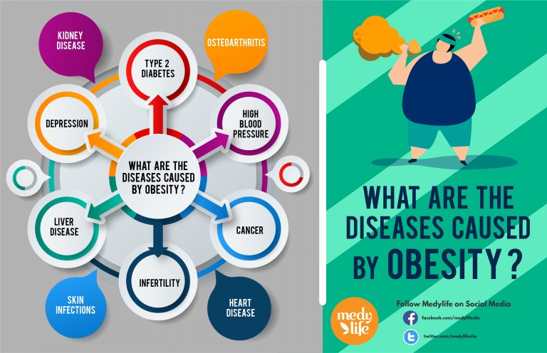Obesity: Why it Happens and the Best ways to Overcome it! - Medy Life
