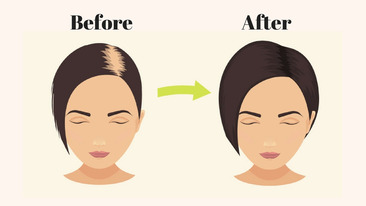 How To Prevent Hair From Falling Out Warexamination15