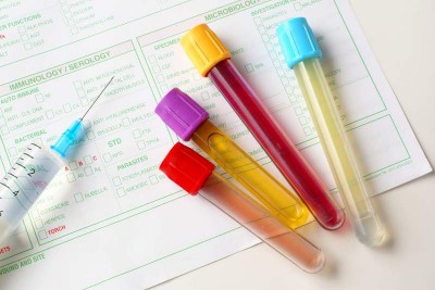 Preparing Mentally For a Blood Test - Medy Life